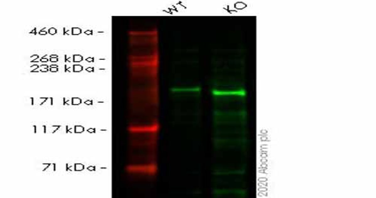 Human ATAD2 knockout HeLa cell line | SelectScience