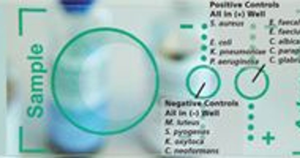 New Rapid Pathogen ID System Launched to Identify Life Threatening ...