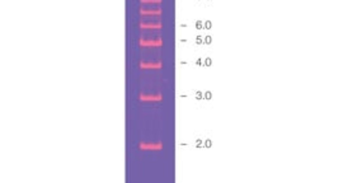 1 kb Molecular Ruler | SelectScience