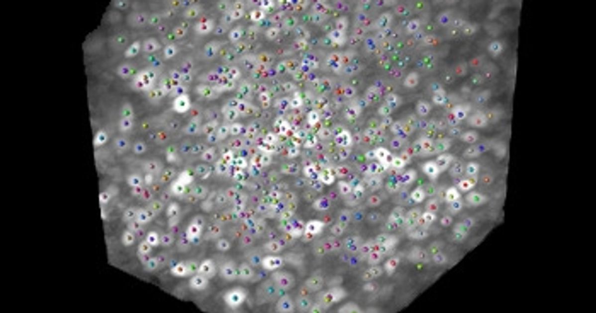 New imaging system brings brains into sharper focus