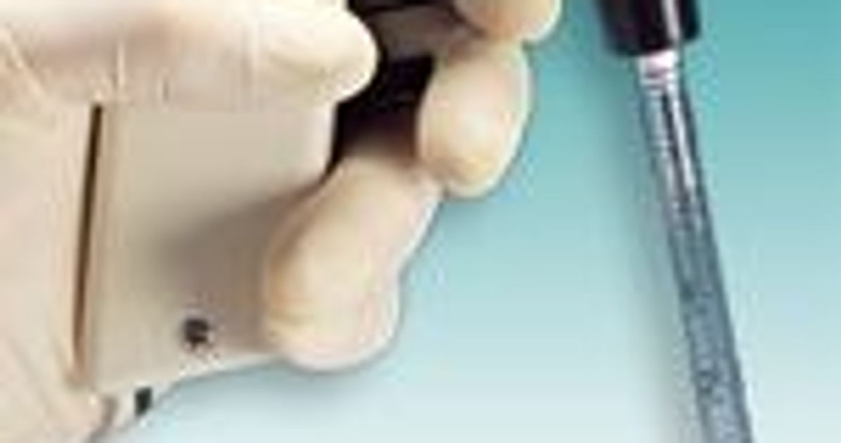 Buy The Original Pipet Aid Read Reviews