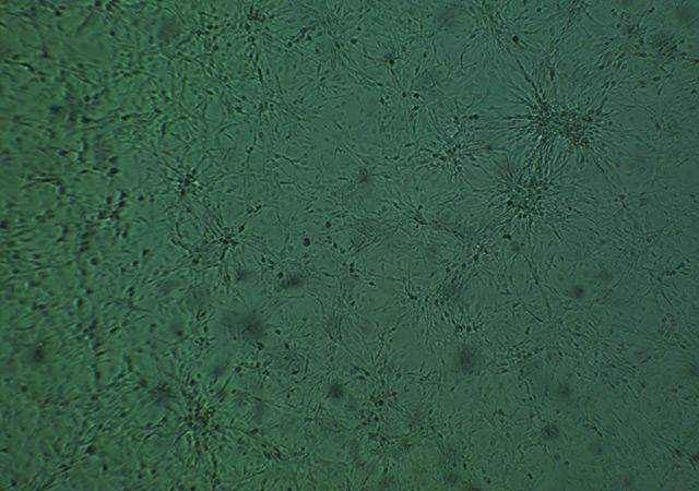 KPC Cell Line (C57/BL6 genetic background) reviews