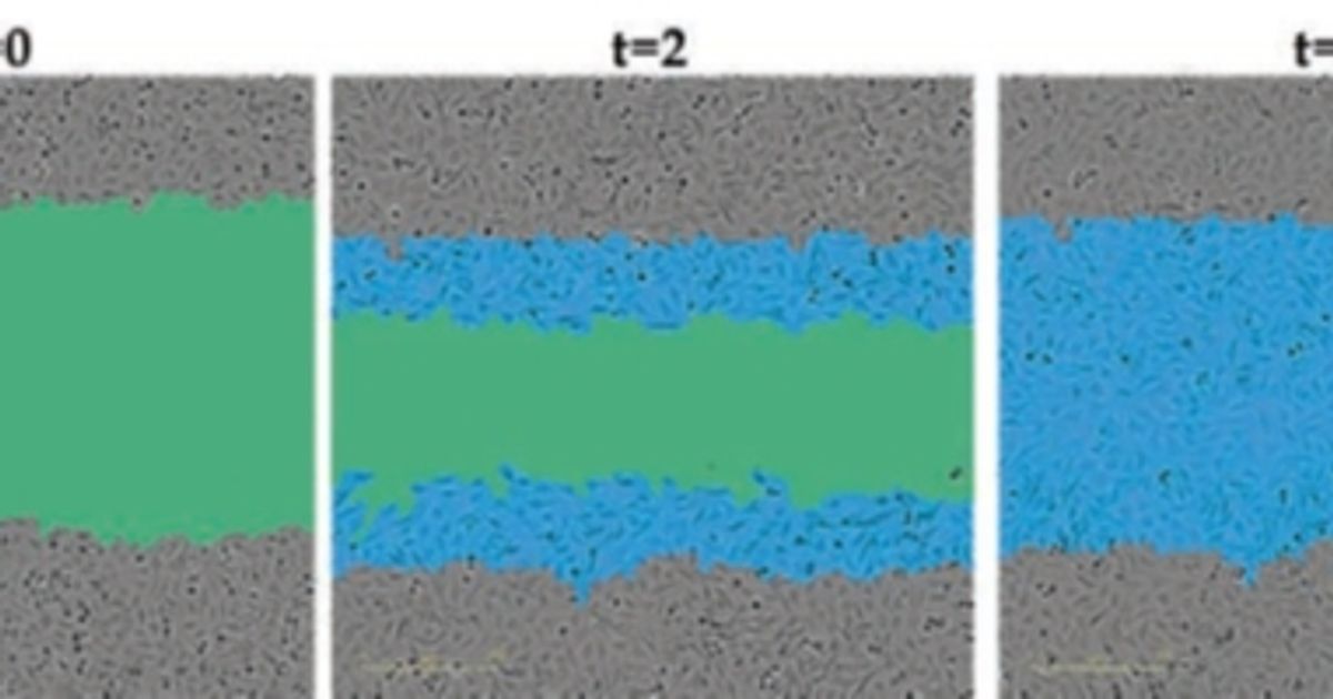 Incucyte® Cell Migration & Invasion System reviews