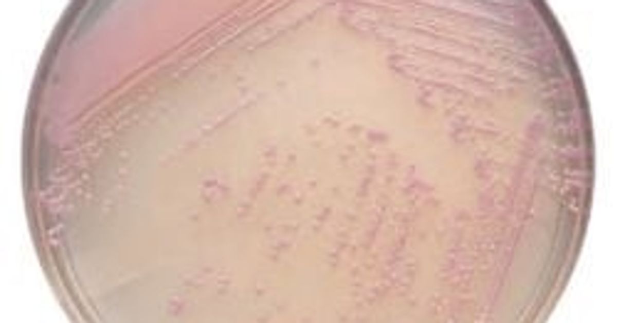 BD BBL™ CHROMagar™ Staph aureus Plate reviews