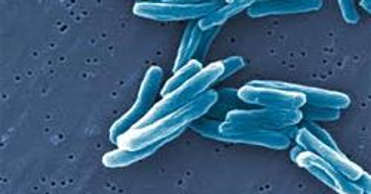 Leading Tuberculosis Experts Explore Shortcomings in Current Immigrant ...