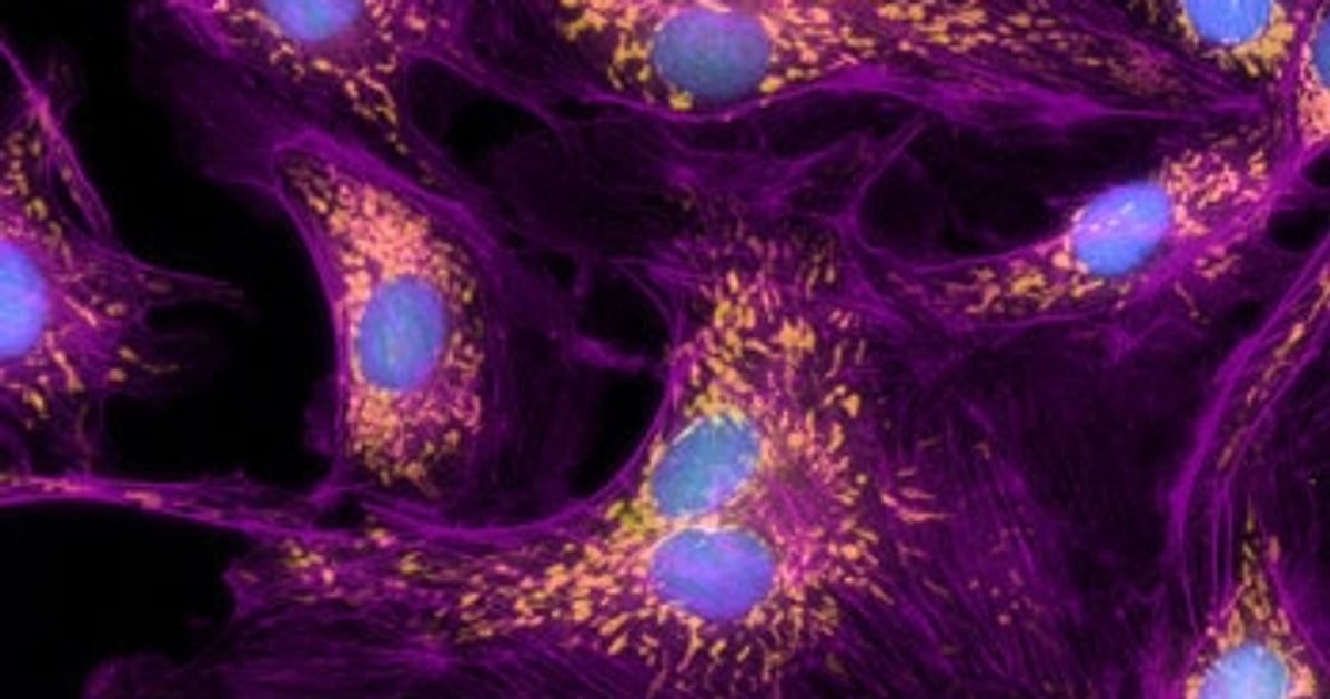 Everything you need to know about the ImageXpress Pico Automated Cell ...