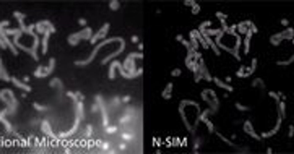 N-SIM Super Resolution Microscope System Provides Double the Resolving ...