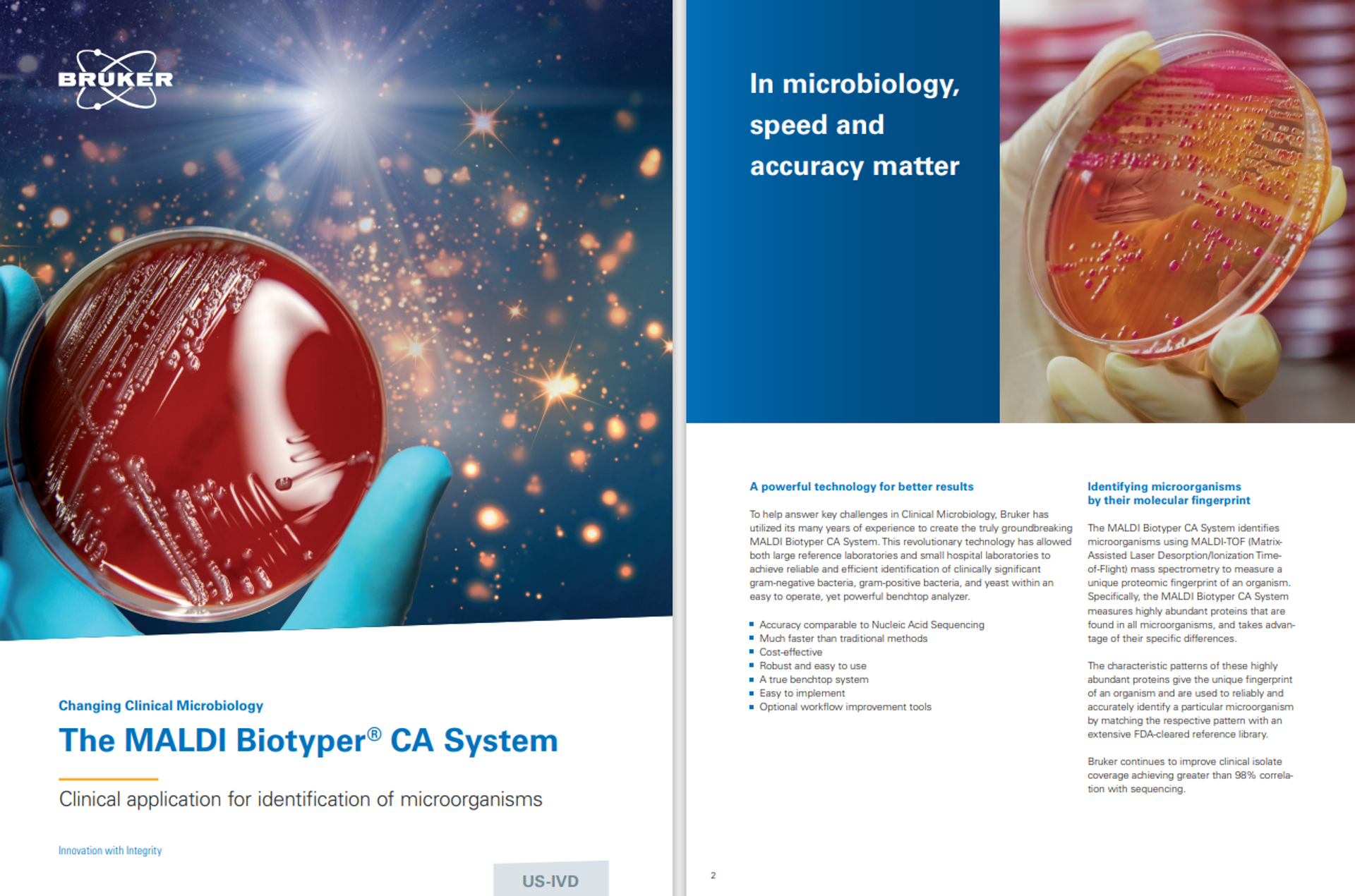 Buy MALDI Biotyper® sirius System Read Reviews