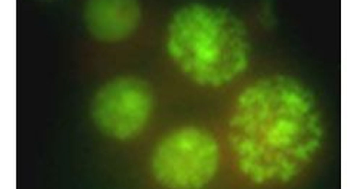 Gentronix Presents Further Validation for the High-Throughput Use of ...