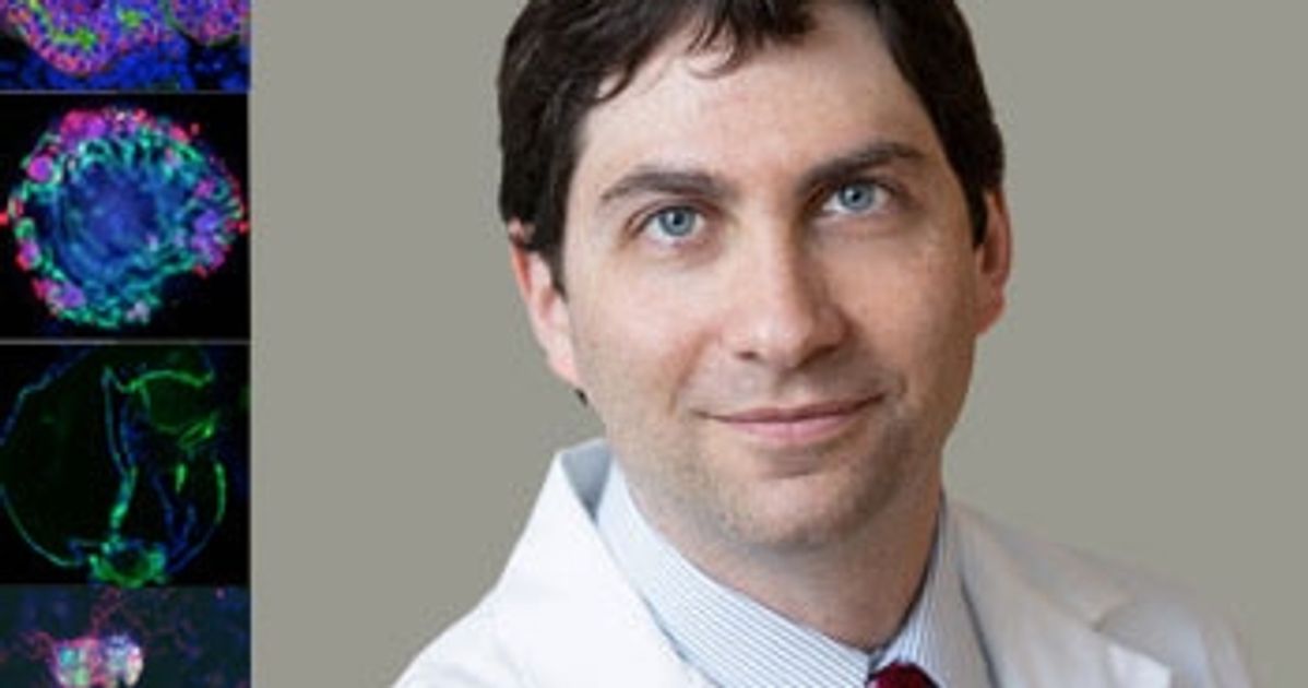 Modeling Kidney Disease with Bioengineered Kidney Organoids