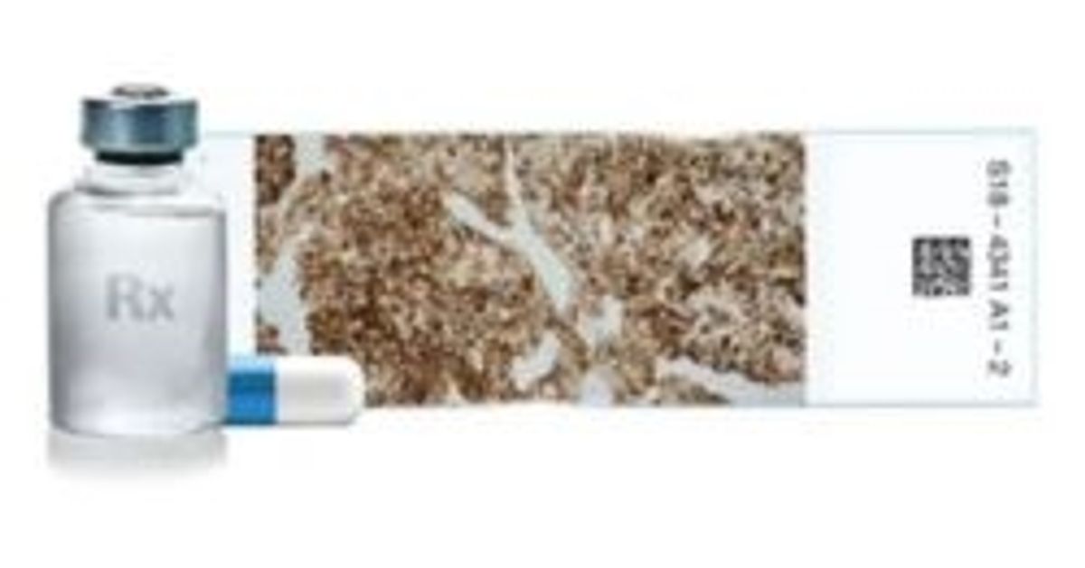 VENTANA FOLR1 (FOLR1-2.1) RxDx Assay reviews