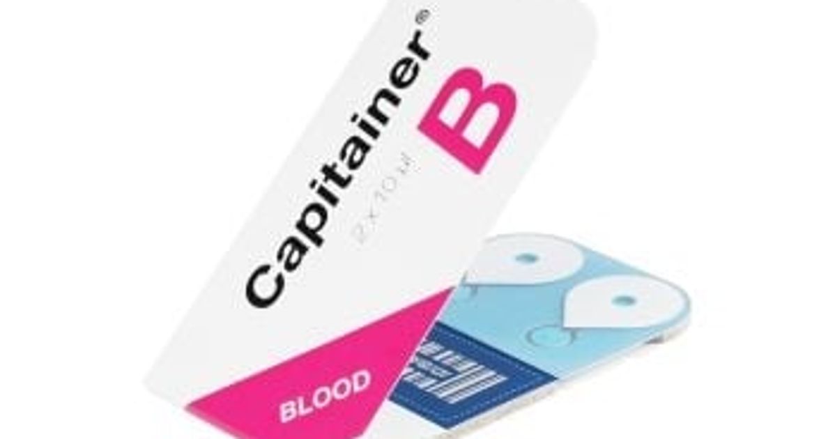 Overcome the challenges of dried blood spot sampling with quantitative ...