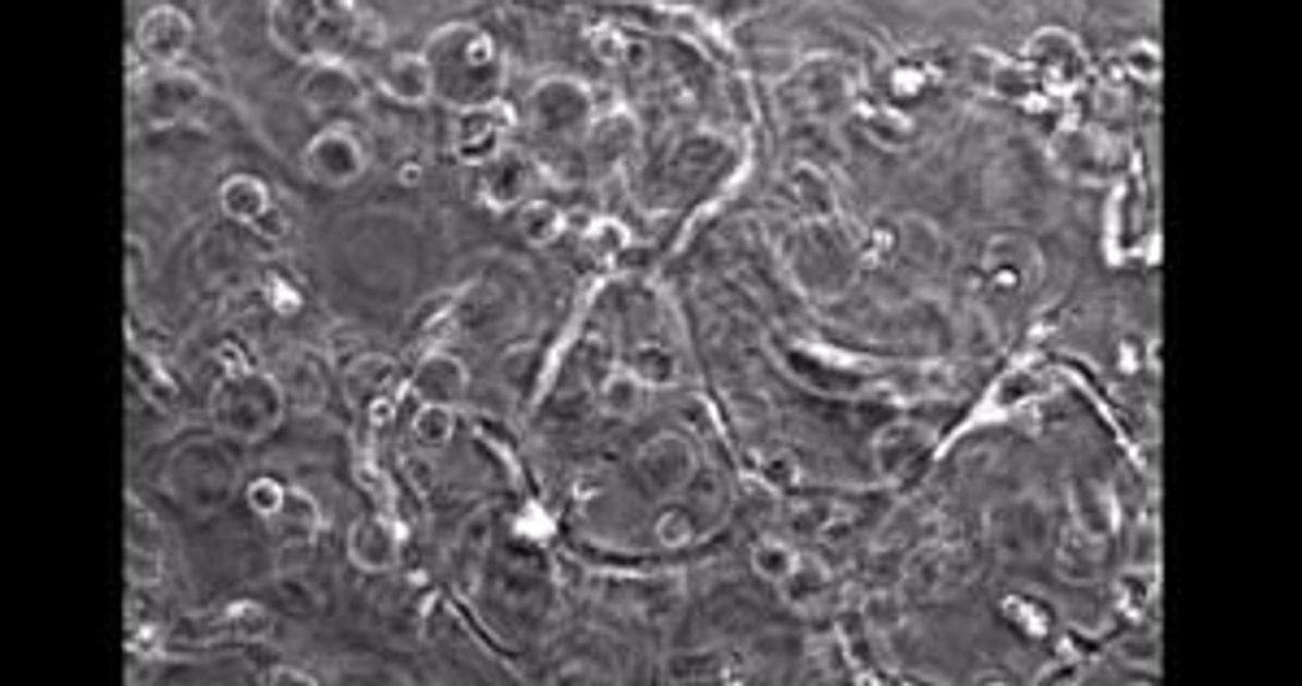 Cellular Dynamics: Capillary-like Network Formation of iCell ...