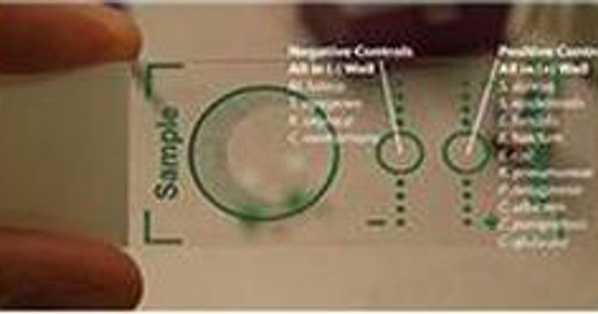 QuickFISH a Rapid Molecular Diagnostic Test for the Identification of ...