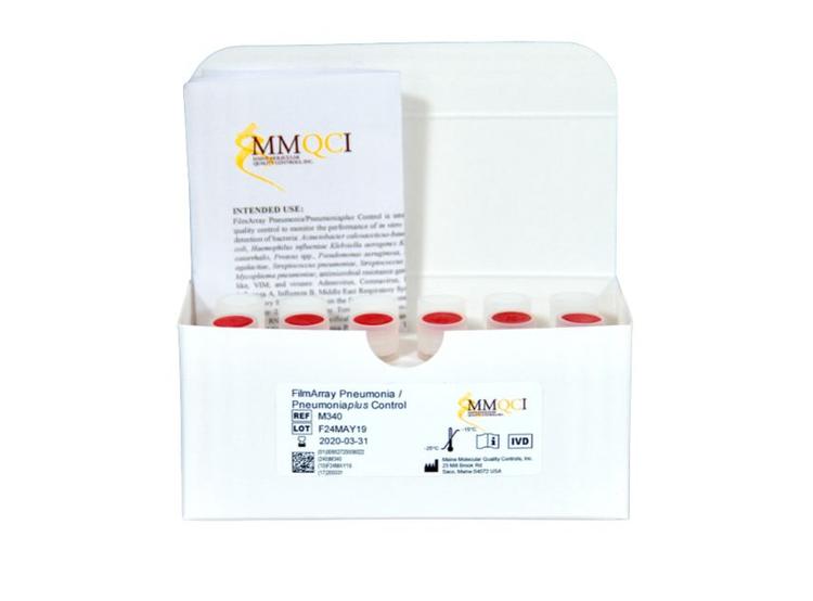 CELL-DYN Ruby Hematology Analyzer