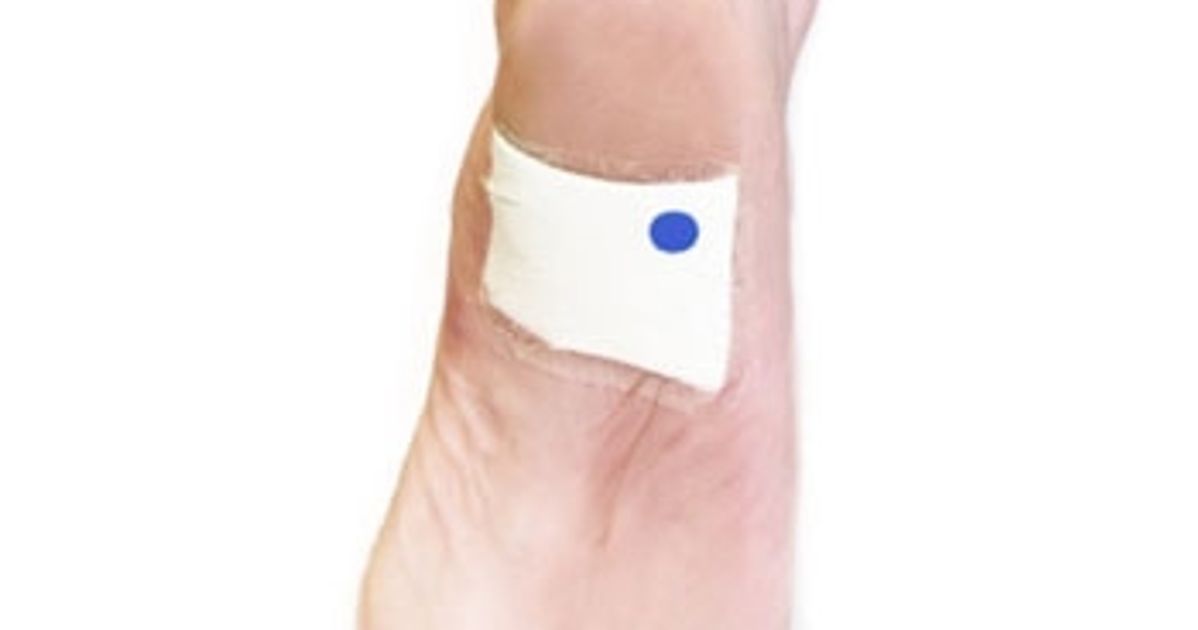 Scientists develop non-invasive indicator that changes color if a wound ...