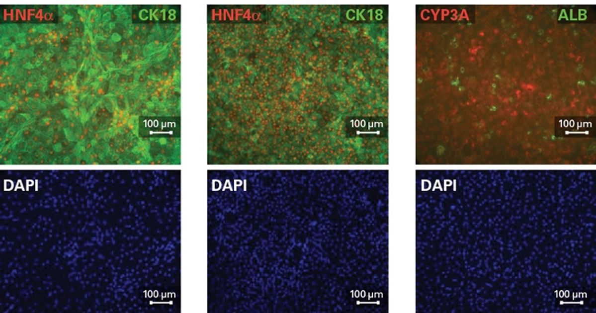 Cellartis® iPS Cell to Hepatocyte Differentiation System