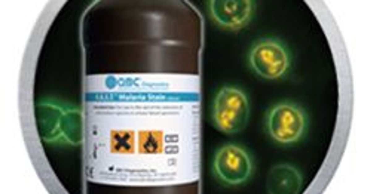 QBC F.A.S.T Stain Offers an Alternative to Giemsa Stains for Malaria ...