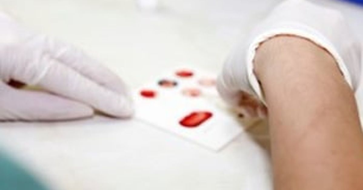 Specialized filter paper for dried blood spot sampling exhibits highly ...