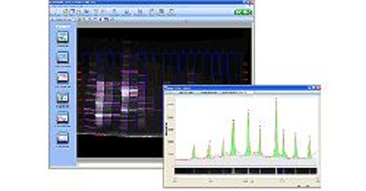Bio-Rad’s New Image Lab Software Automates Total Protein Normalization ...