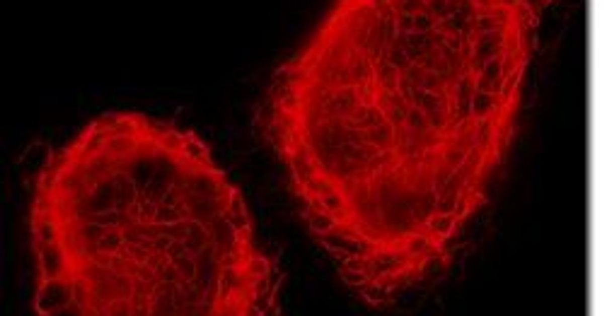 Omega Optical Introduces Filter Sets For New Keima-Red Fluorescent Protein