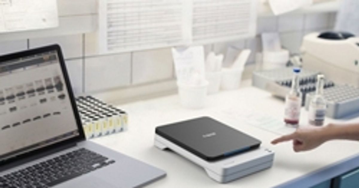 Buy Electronic Film Western Blot Imaging system Read Reviews