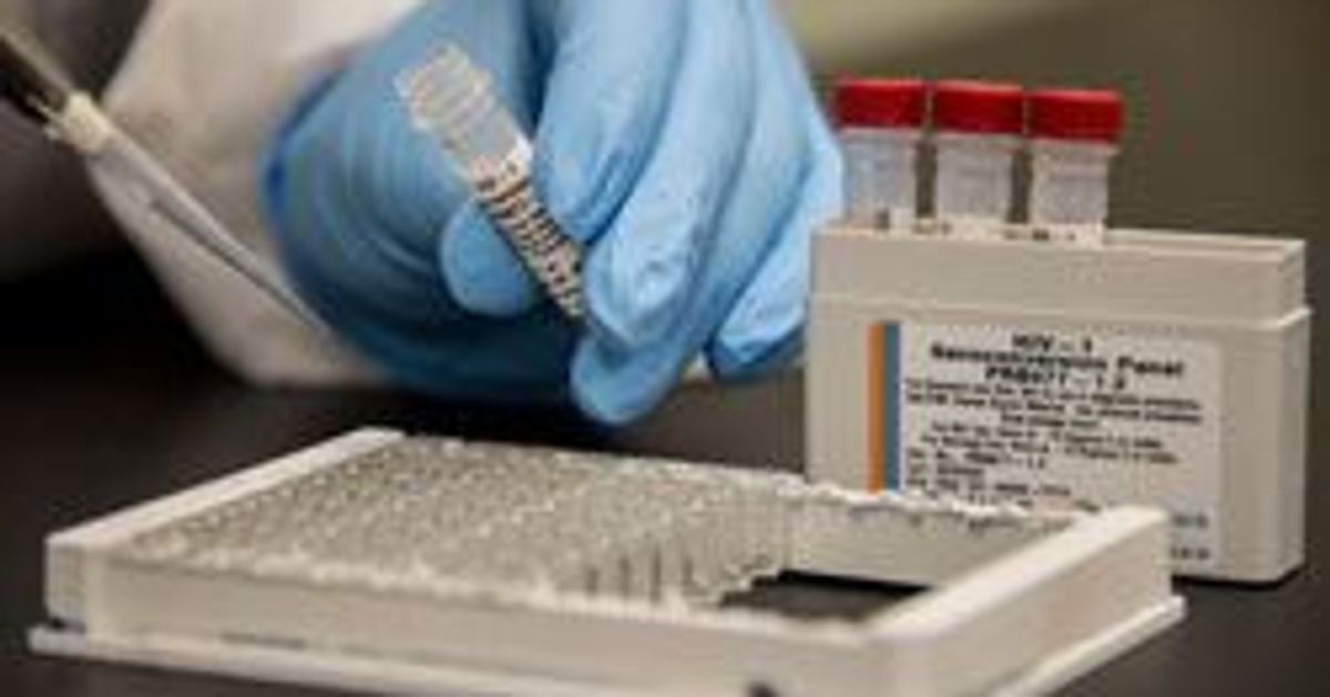 SeraCare Introduces New Seroconversion Panels for Hepatitis B and HIV