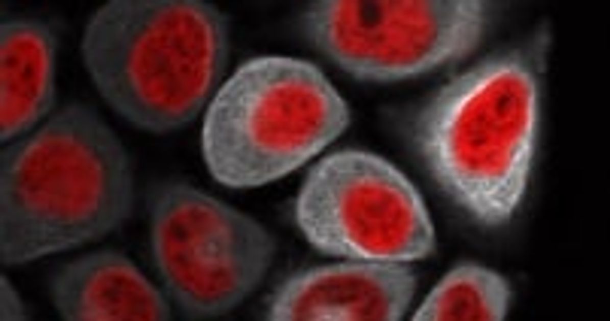 HeLa Kyoto EGFP-alpha-tubulin/H2B-mCherry