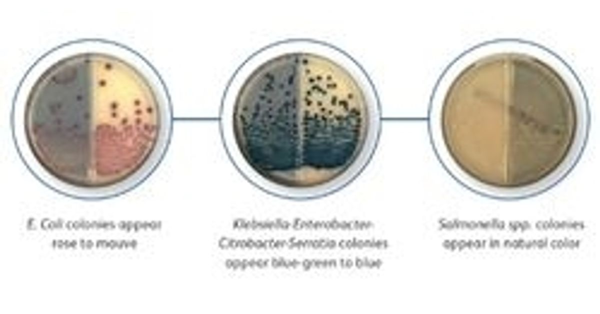 Bi-plate BD BBL™ CHROMagar™ ESBL reviews