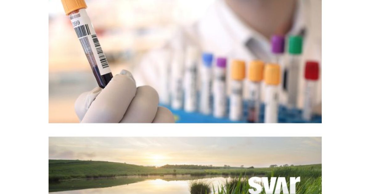 Autoimmunity Diagnostics