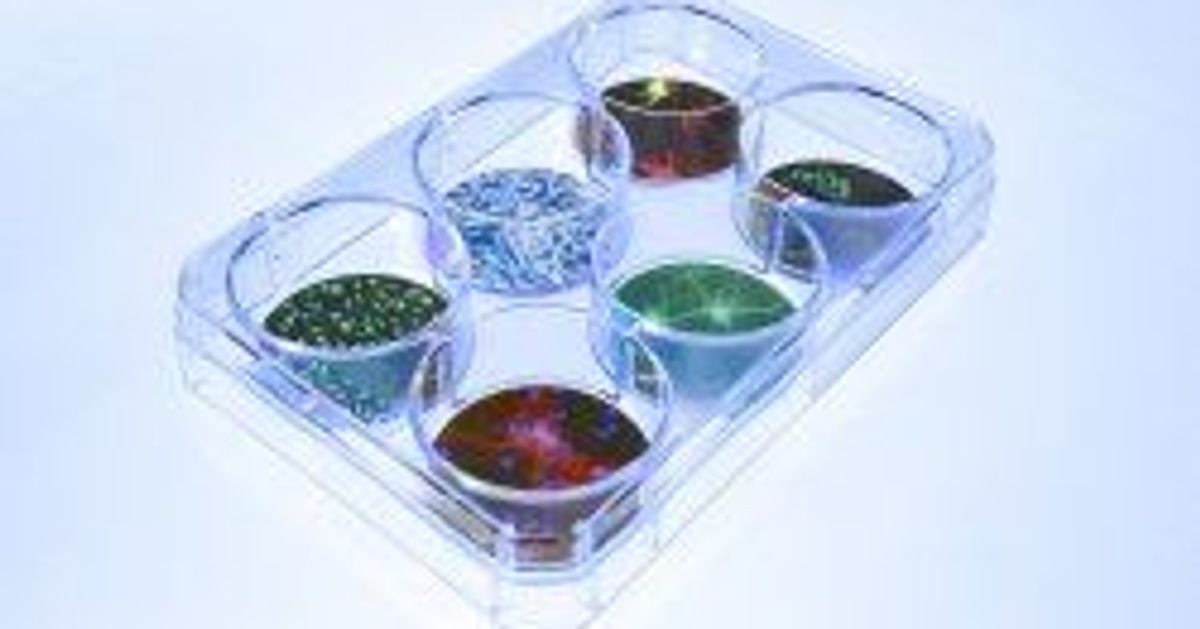 Cell-based strategies ensure high transfection efficiency