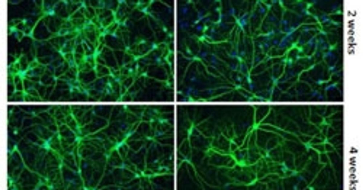 Improving Overall Growth and Performance of Primary Neurons