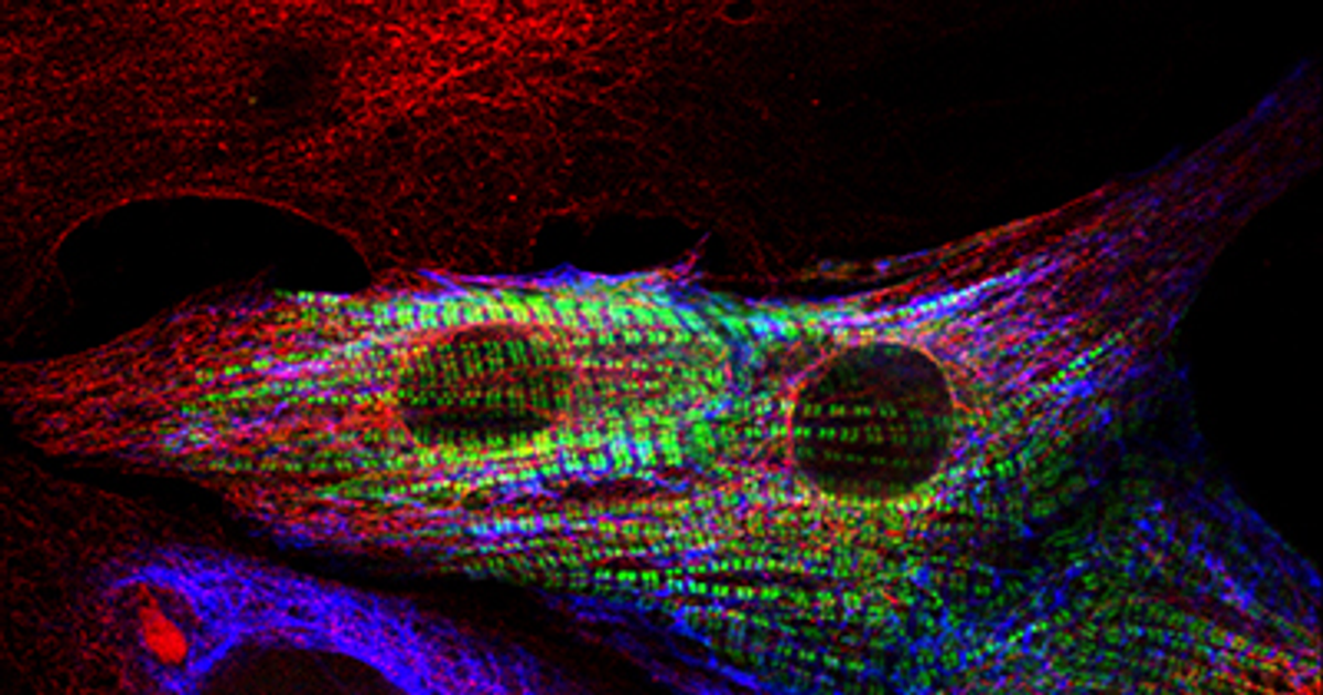 Imaging with Jackson ImmunoResearch Secondary Antibodies