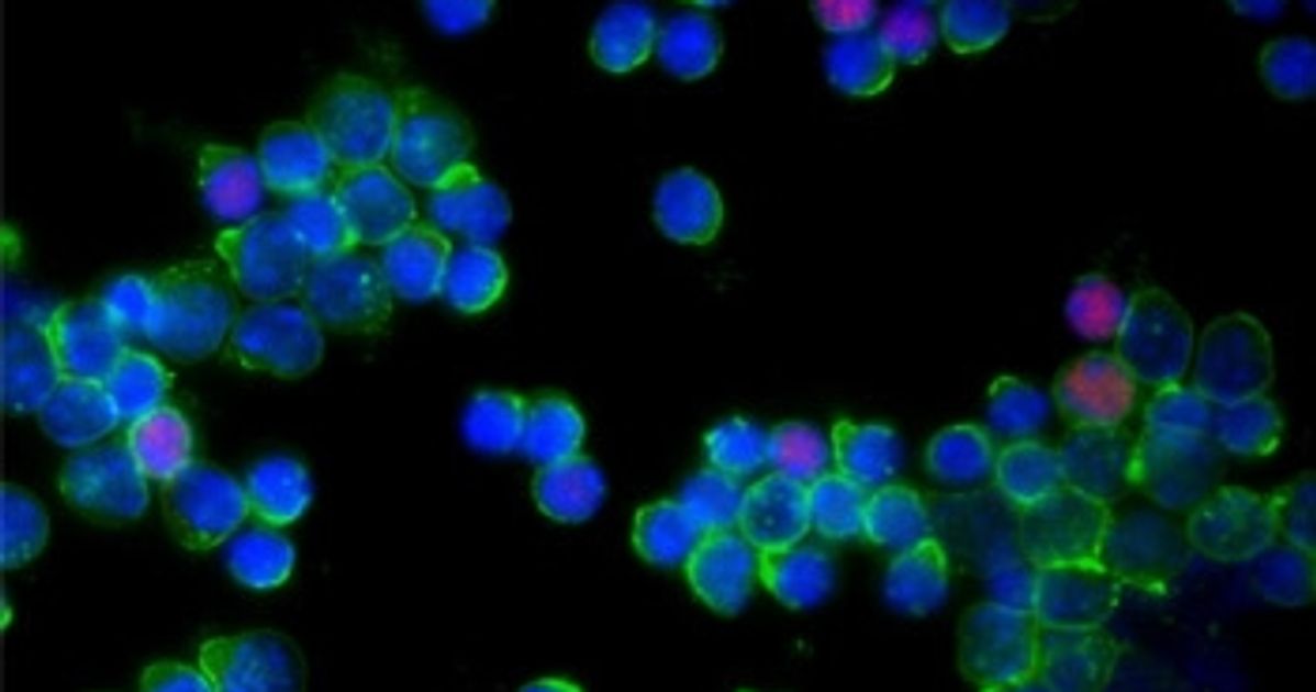 Severe COVID-19 infection linked to overactive immune cells