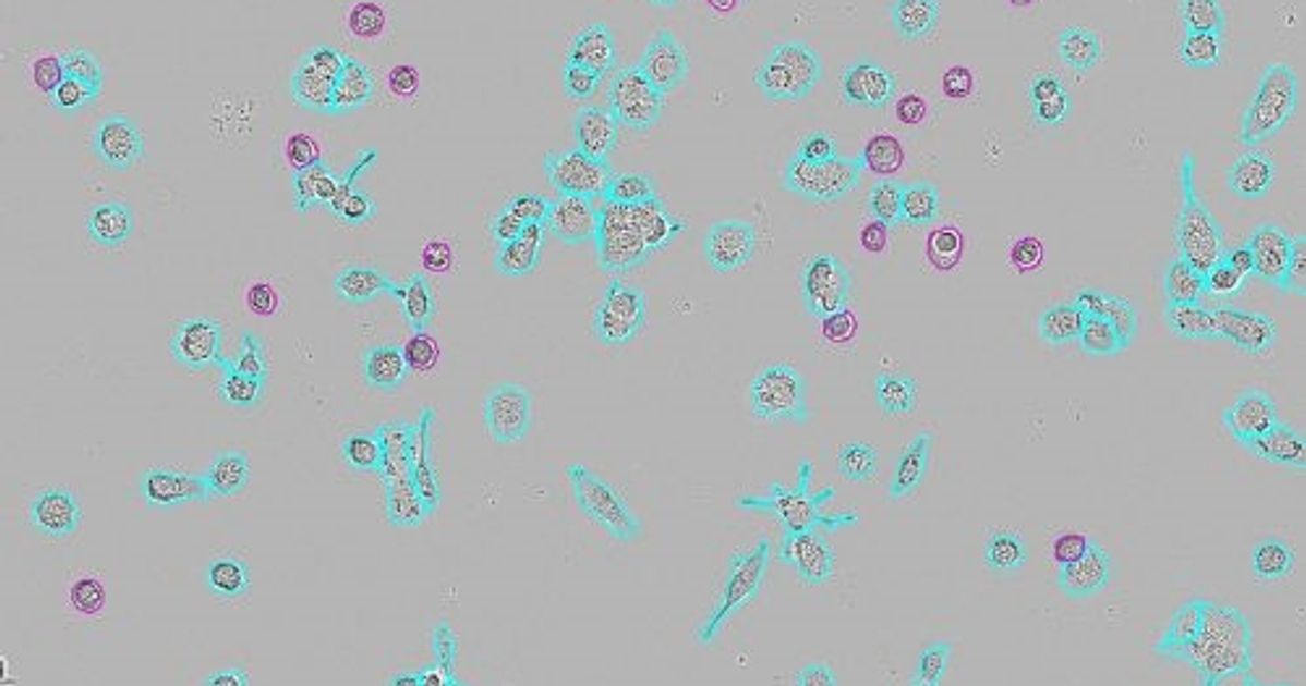 Incucyte® Advanced Label-Free Classification Analysis Software Module
