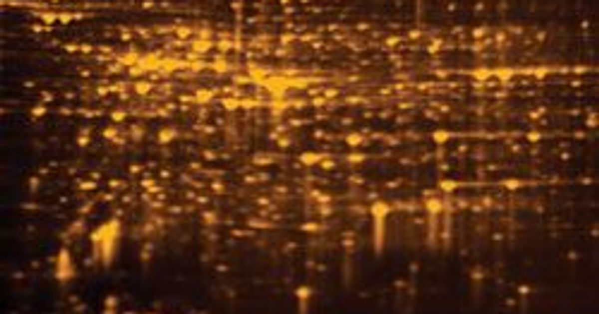 Bio-Rad Announces New Oriole™ Fluorescent Gel Stain