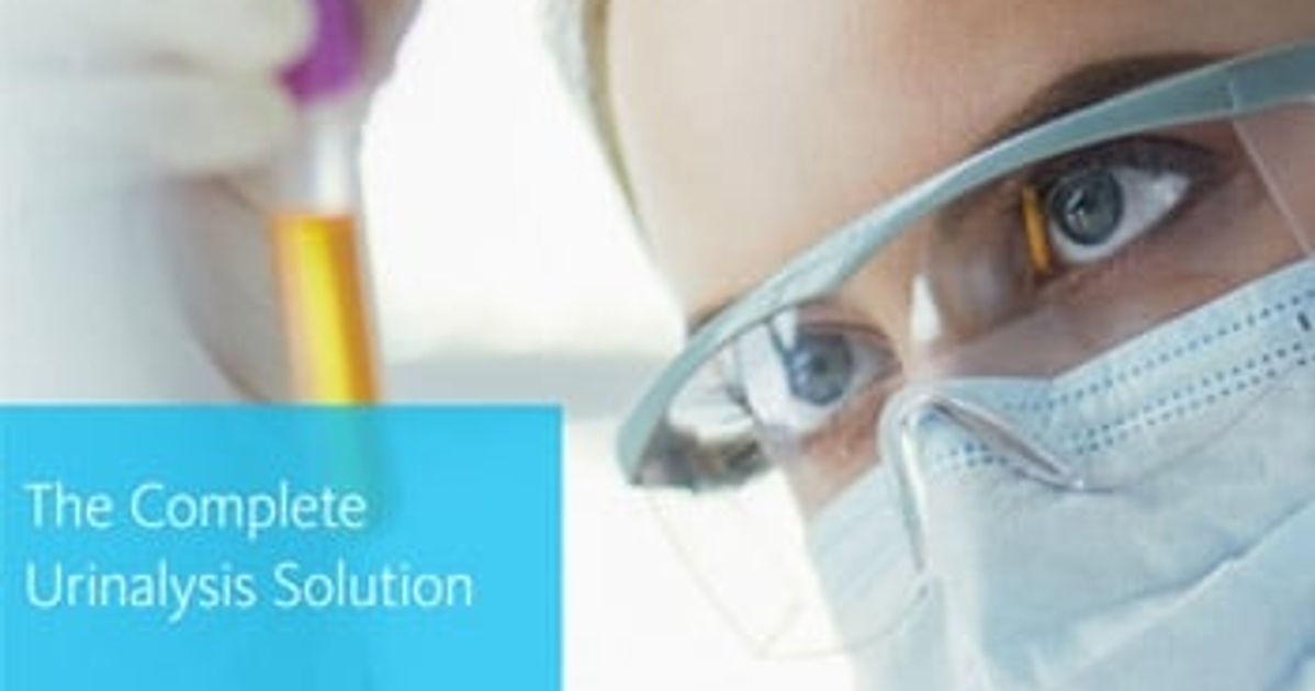 Sysmex launches next-generation fully automated blood coagulation ...