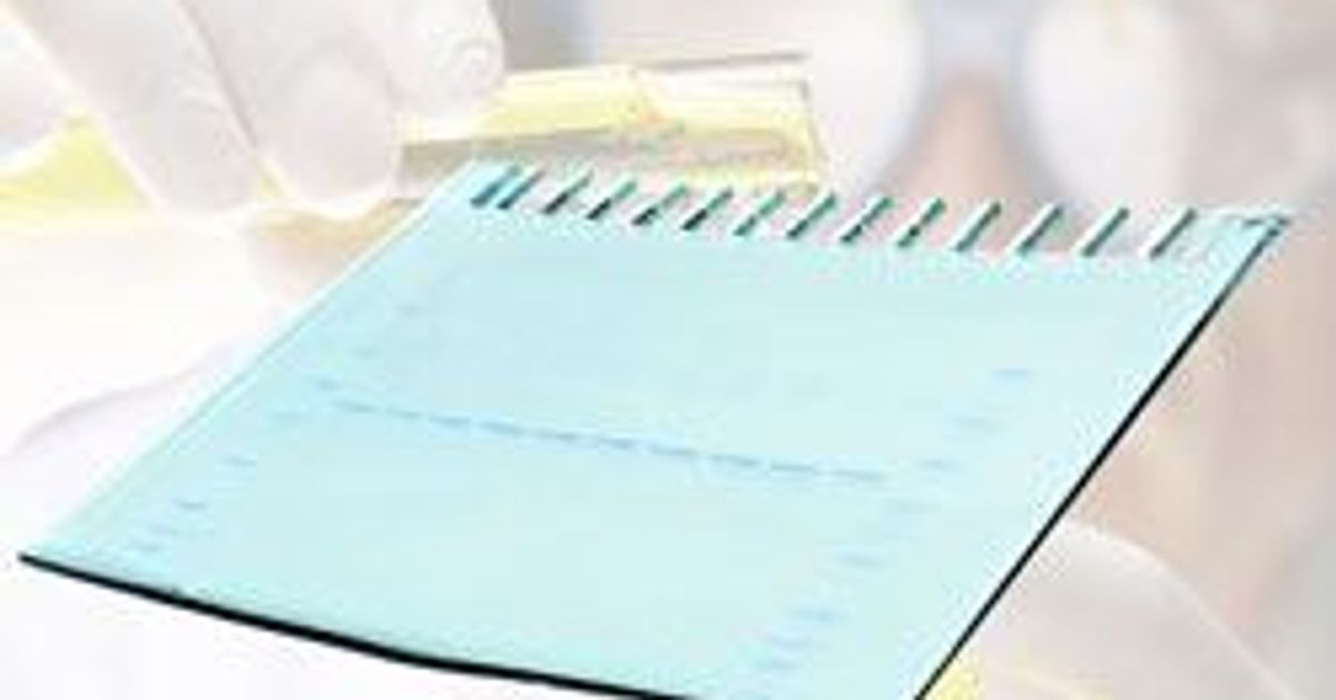 New Precast Gels from CLEAVER SCIENTIFIC Provide Speed, Convenience and ...