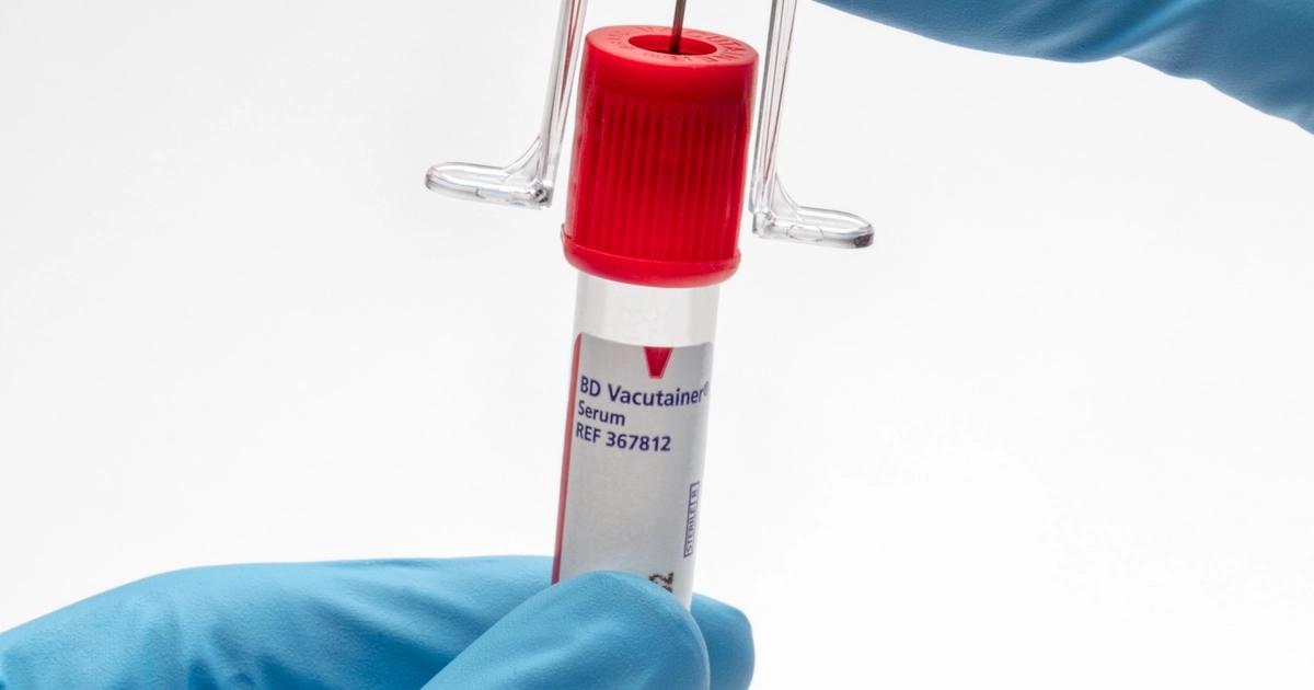 Blood drop dispensers reviews