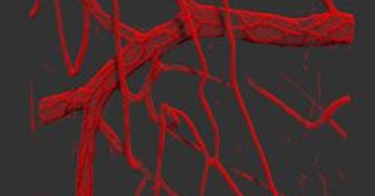 Bitplane Imaris 4D Software Helps The Centre for Microvascular Research ...