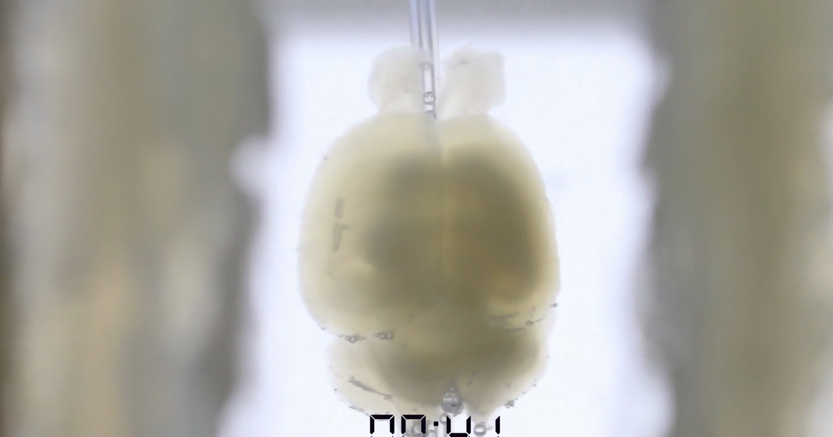 Time Lapse Video of a Mouse Brain Being Cleared