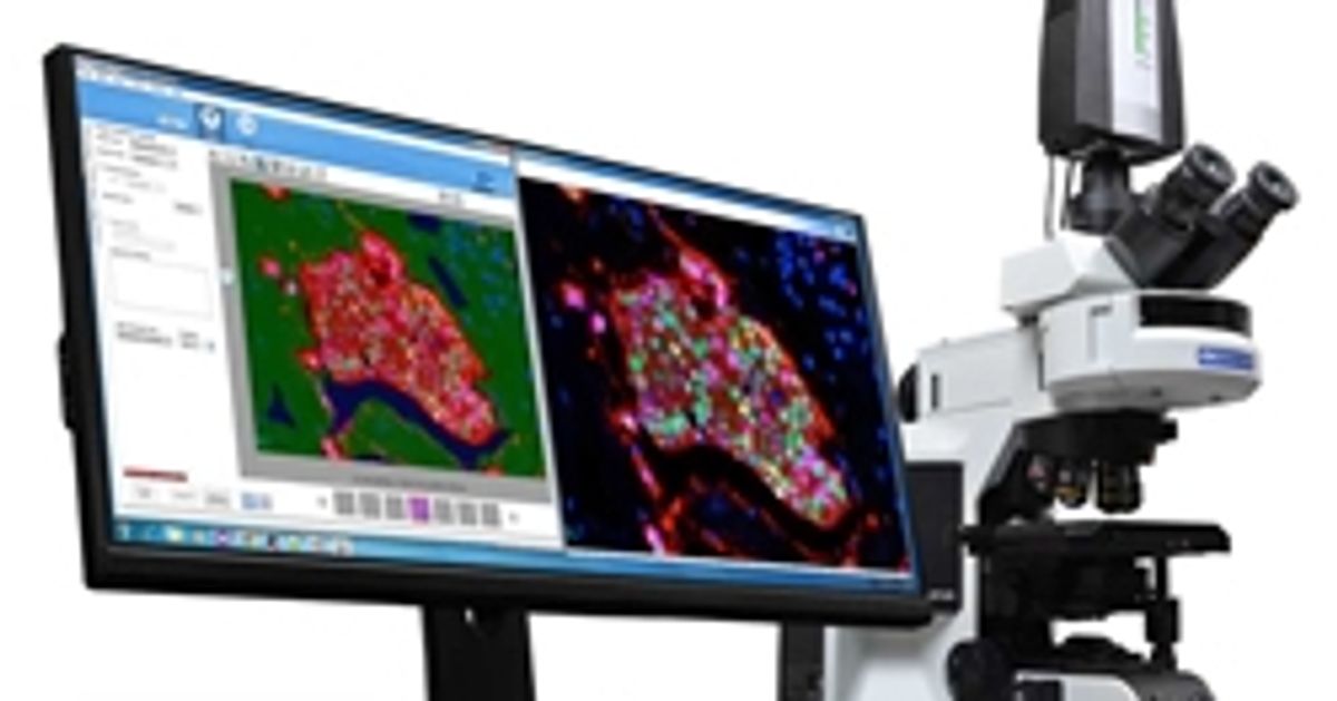 PerkinElmer Launches Mantra™ Quantitative Pathology Imaging System for Cancer Immunology Research