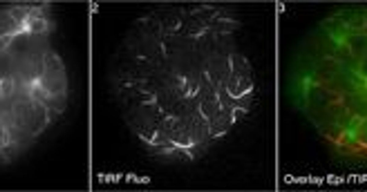 Visitron TIRF system