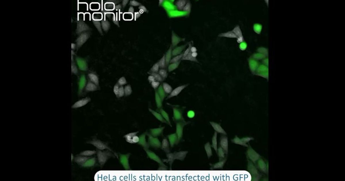Real-time live imaging of GFP-tagged HeLa cells