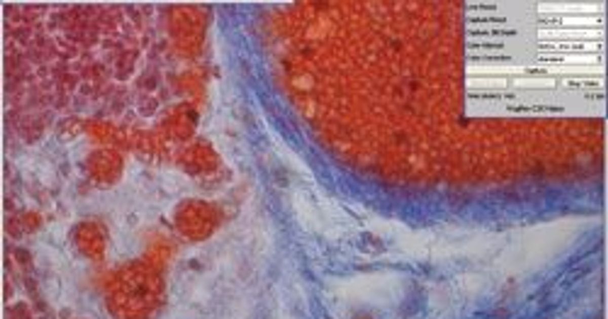 ImageJ driver available for ProgRes ® microscope cameras from Jenoptik