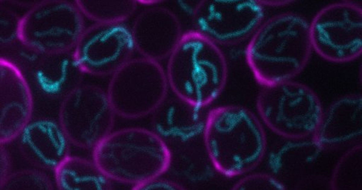 Elucidating Aging Mechanisms Using Advanced Live Cell Imaging Technology