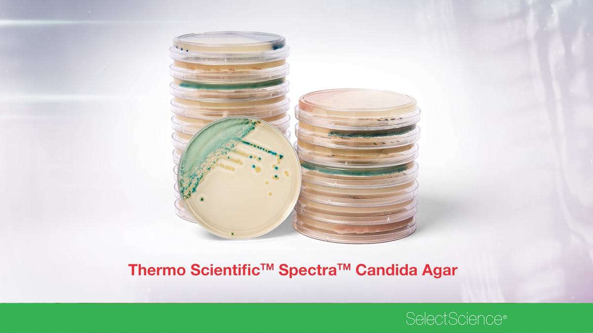 Enhanced Candida detection using Spectra chromogenic agar