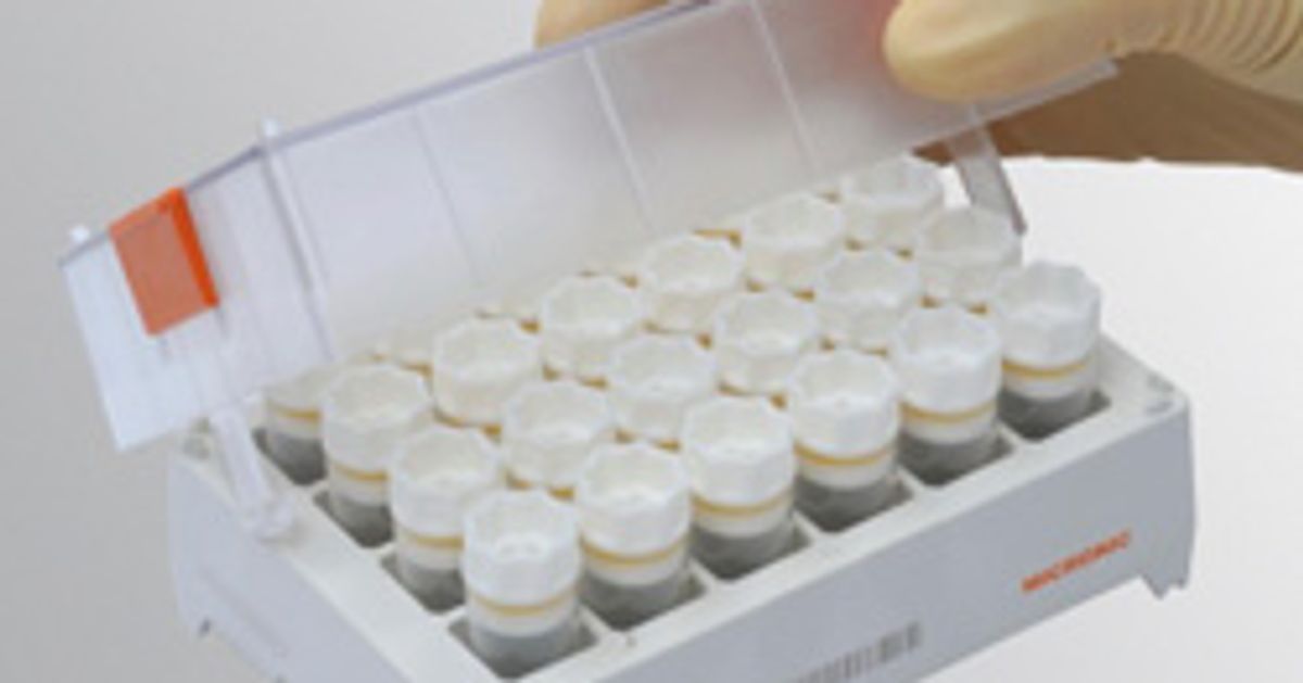 Cryogenic Storage Rack for High Volume Samples