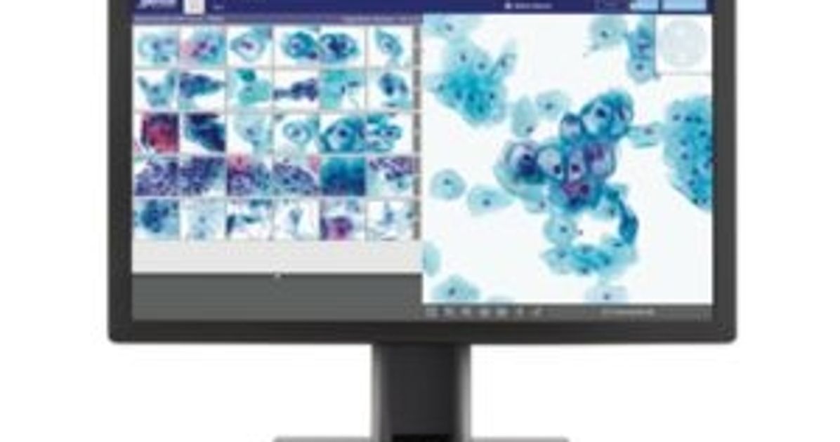 Hologic announces first and only FDA-cleared digital cytology system – Genius™ Digital ...