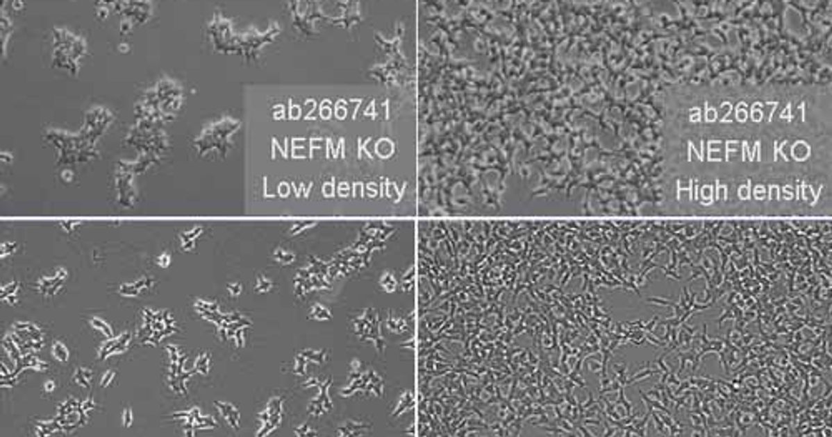 Human NEFM (160 kD Neurofilament Medium) knockout HEK293T cell line ...